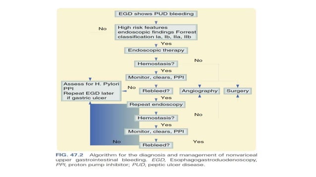 Approach to Upper GI Tract Bleed (UGI Bleed).pptx