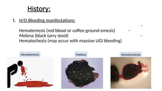 APPROACH TO UGI Bleeding (1).ppt DR. SAMSMSMSMSMSMx | PPTX