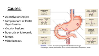 APPROACH TO UGI Bleeding (1).ppt DR. SAMSMSMSMSMSMx | PPTX