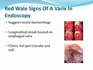 Approach to UGI bleed Dr Kandy | PPT