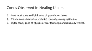 APPROACH TO ULCERS.powerpoint for medical students | PPT