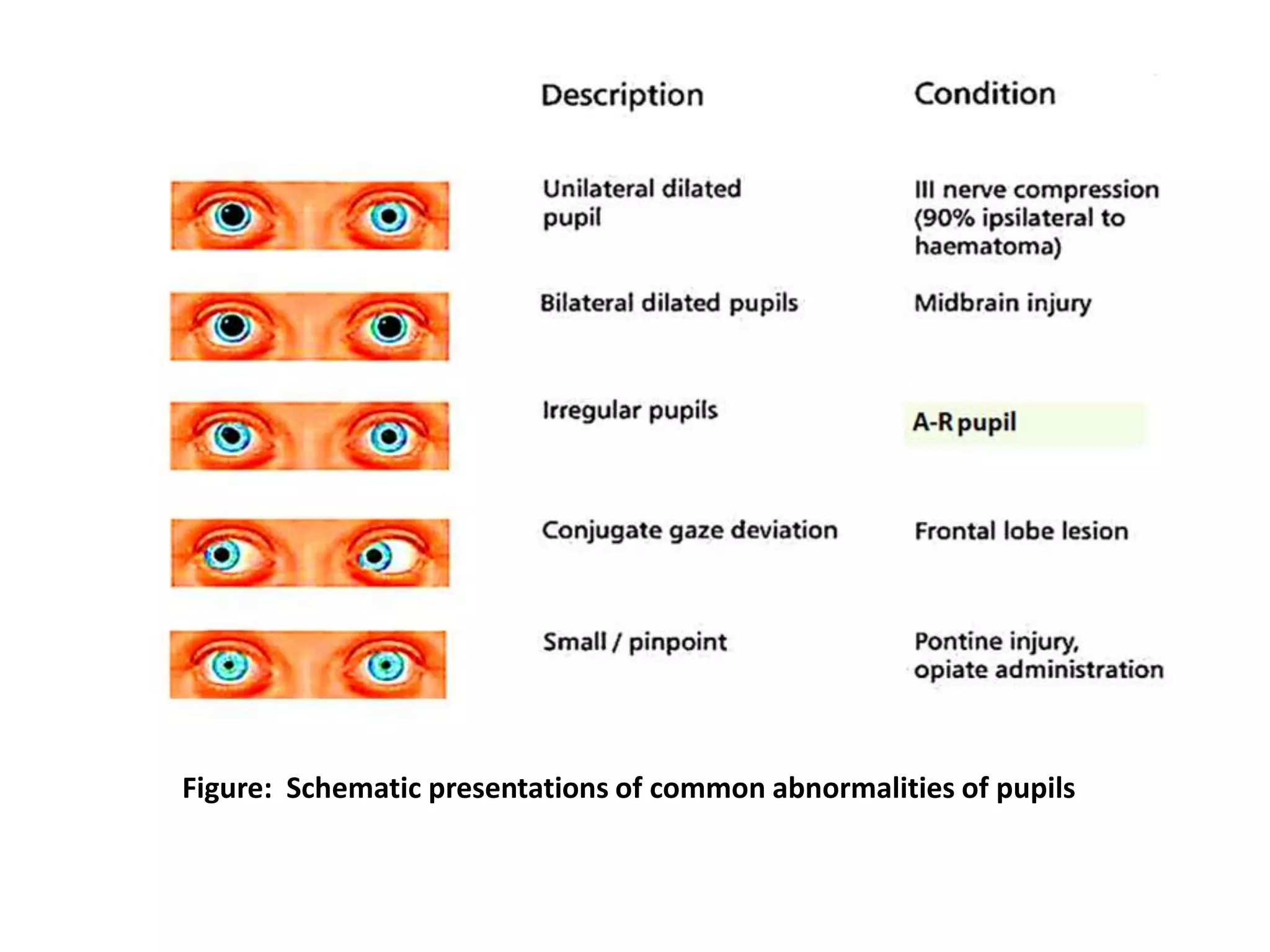 Approach to unconsciousness | PPTX