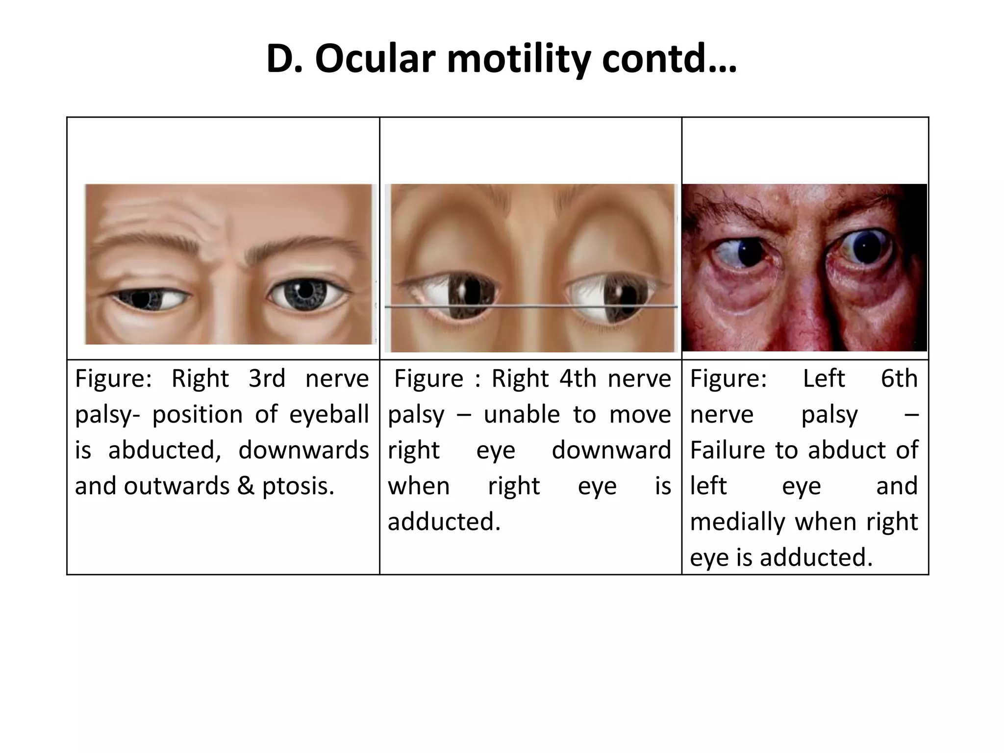 Approach to unconsciousness | PPTX