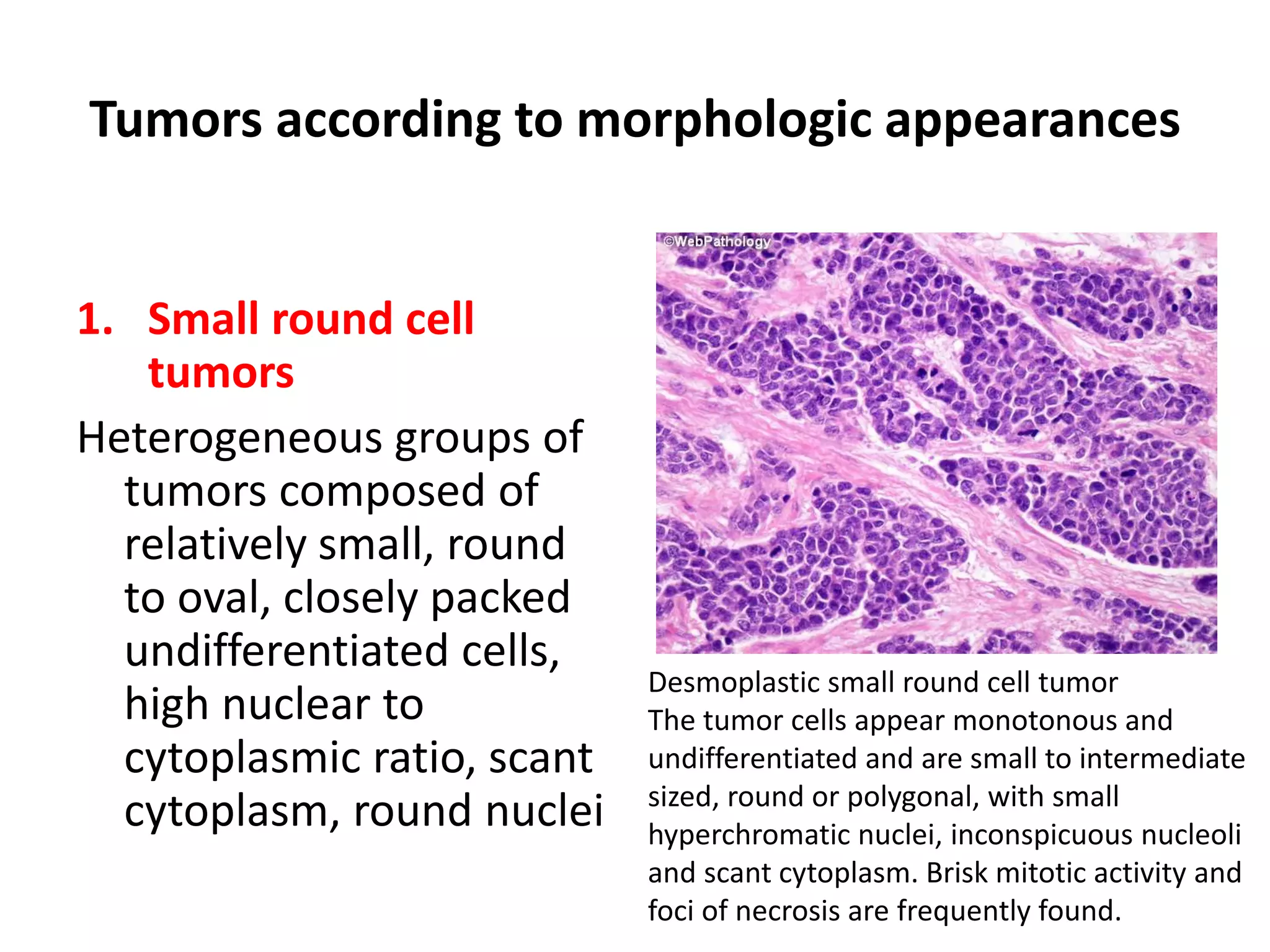 Approach to undifferentiated tumors | PPTX