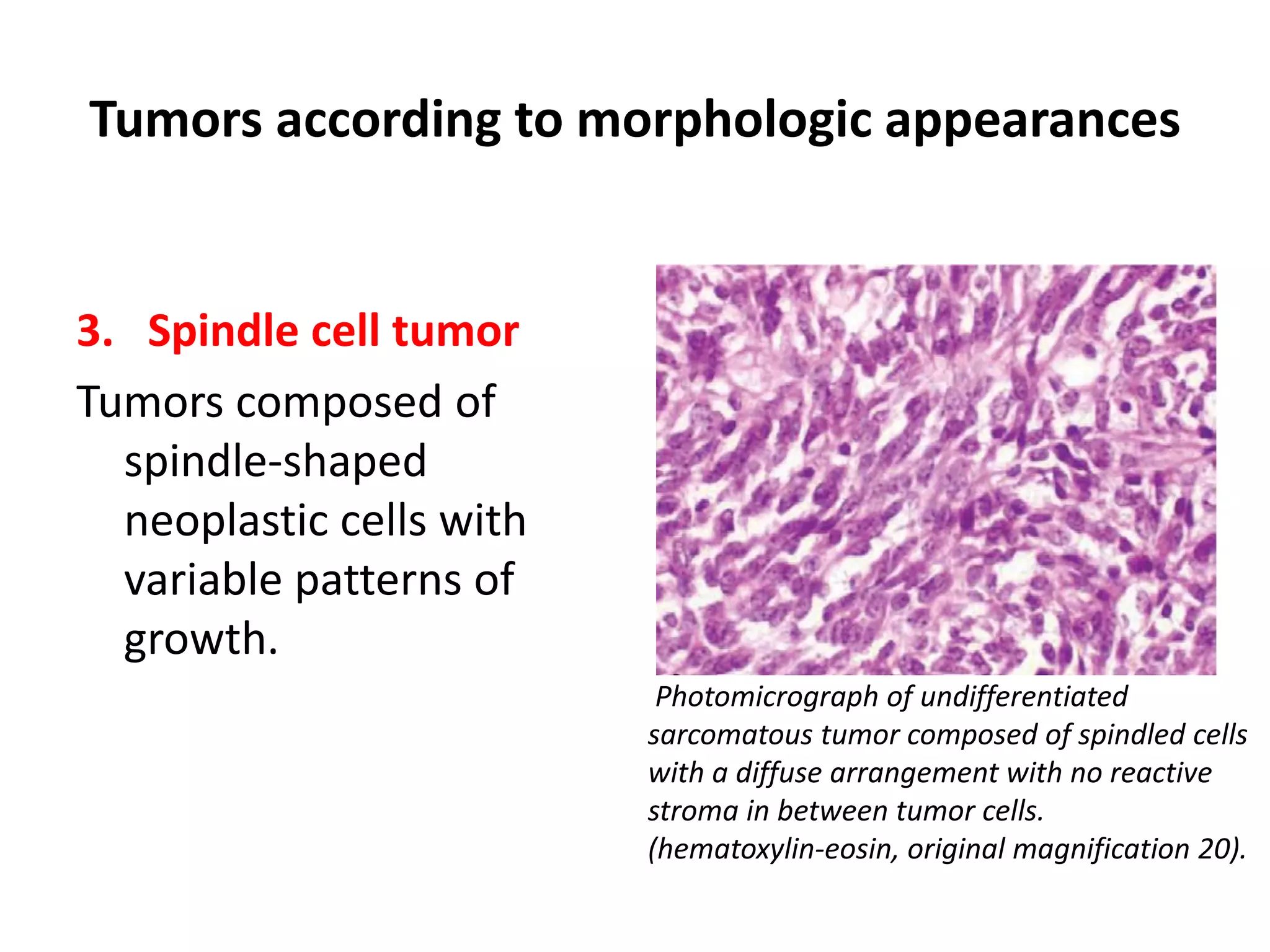 Approach to undifferentiated tumors | PPTX