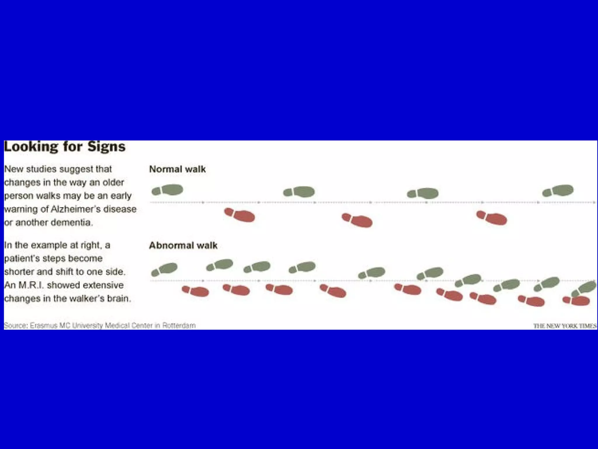 Approach to unsteadiness and gait disorders | PPT