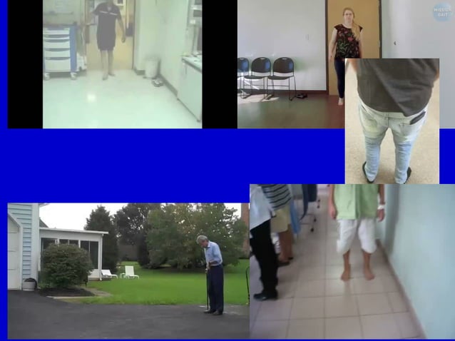 Approach to unsteadiness and gait disorders | PPT