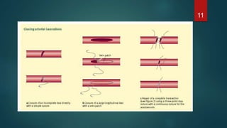 APPROACH TO VASCULAR REPAIR, VASCULAR GRAFTS.pptx