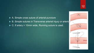 APPROACH TO VASCULAR REPAIR, VASCULAR GRAFTS.pptx