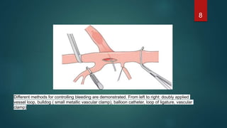 APPROACH TO VASCULAR REPAIR, VASCULAR GRAFTS.pptx