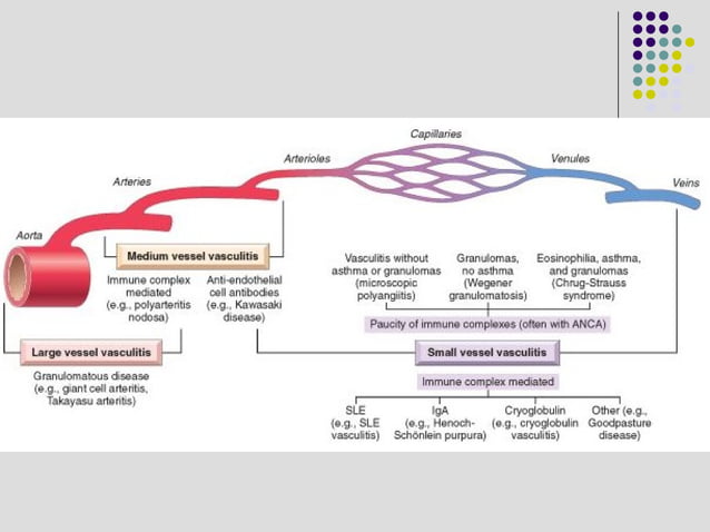 Approach to vasculitis | PPT