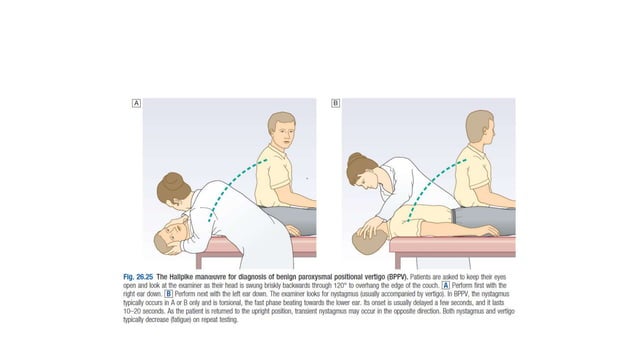 Approach to vertigo | PPTX