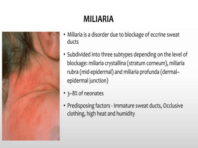 Approach to vesiculo bullous papular lesion in neonates | PPTX | Skin ...