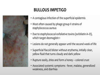 Approach to vesiculo bullous papular lesion in neonates | PPTX