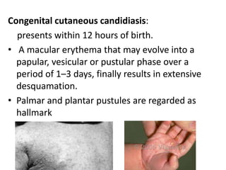 Approach to vesiculo bullous papular lesion in neonates | PPTX