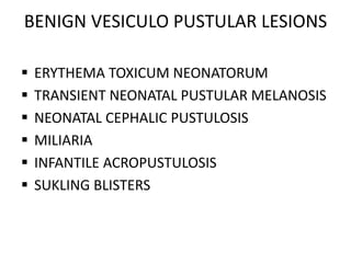 Approach to vesiculo bullous papular lesion in neonates | PPTX