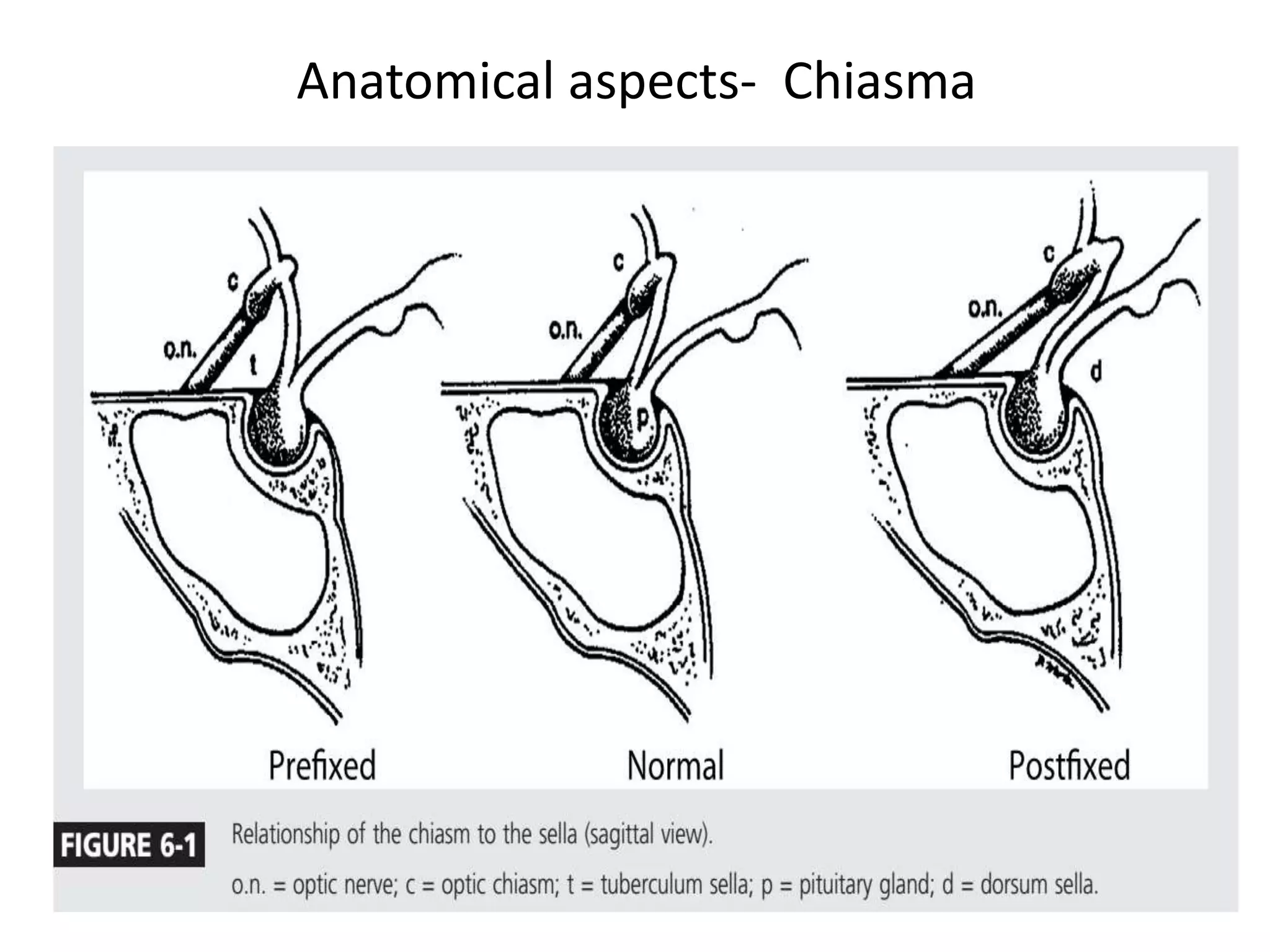 Approach to vision loss | PPTX