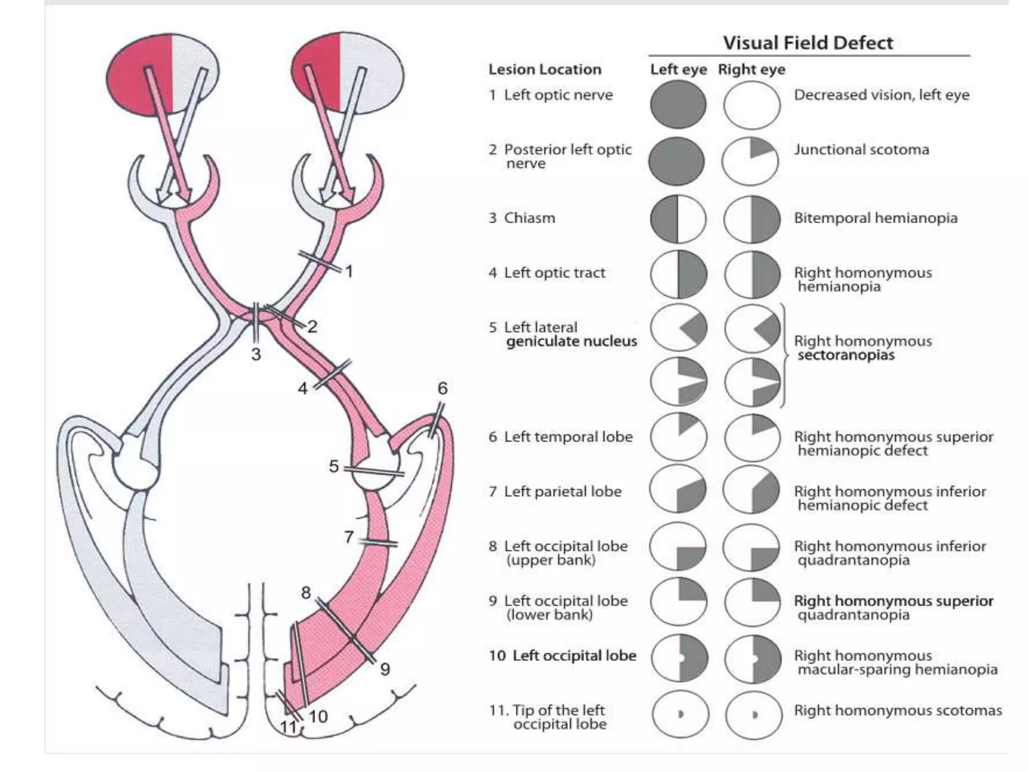 Approach to vision loss | PPTX
