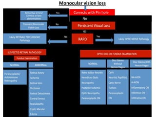 Approach to vision loss | PPTX