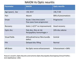 Approach to vision loss | PPTX