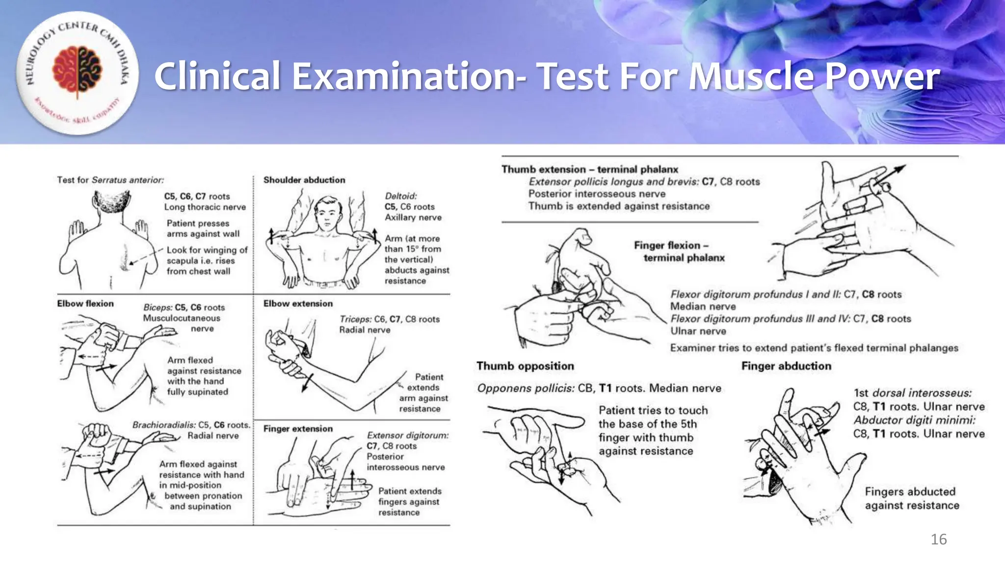 Approach to Wasted Hand (Neurology short case series).pptx