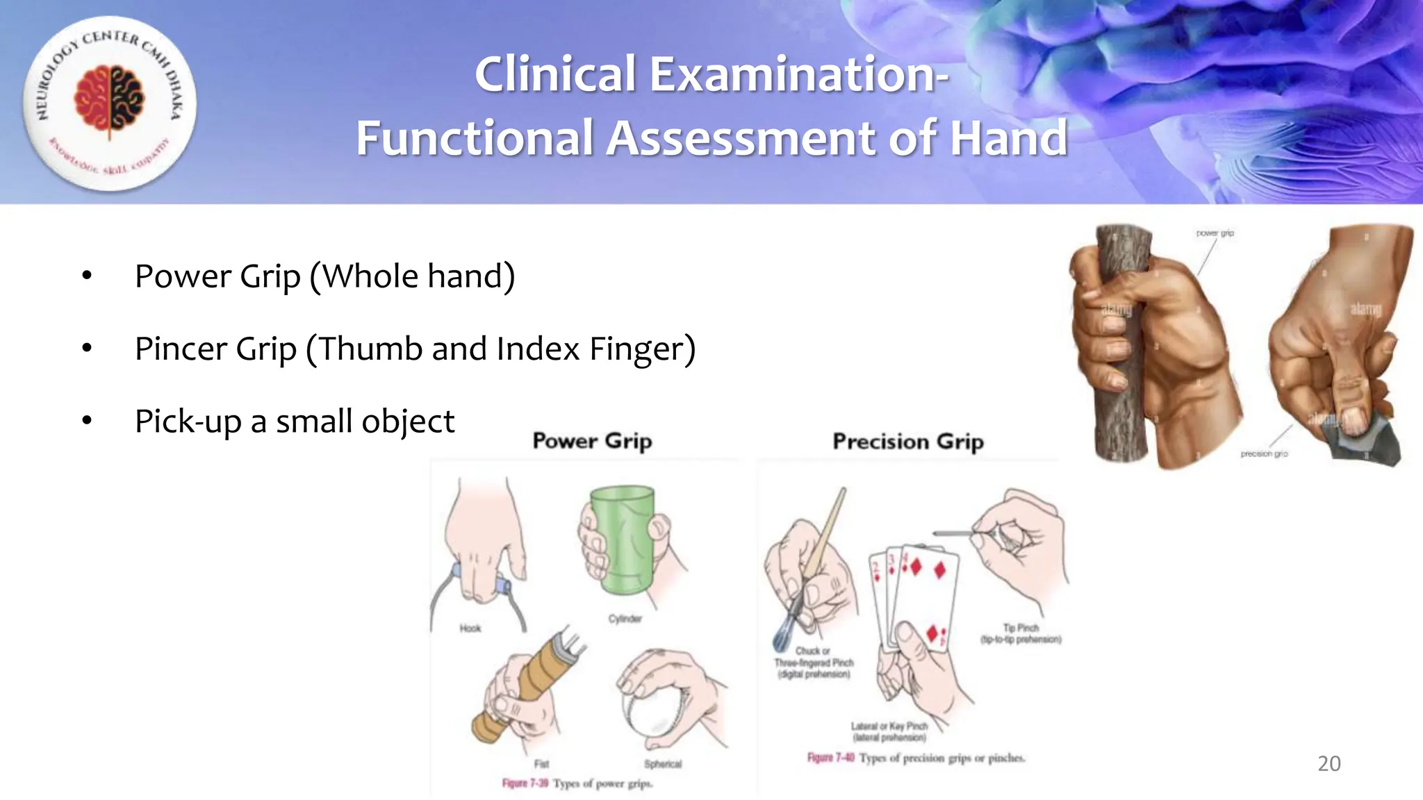 Approach to Wasted Hand (Neurology short case series).pptx