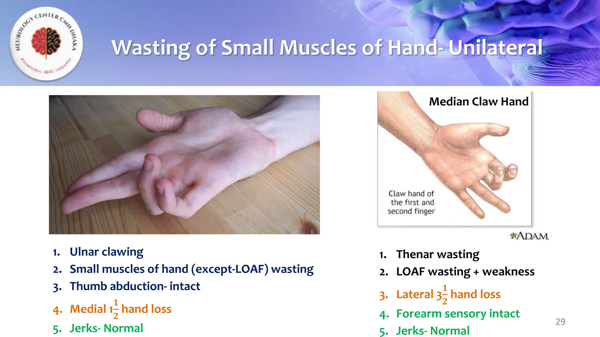 Approach to Wasted Hand (Neurology short case series).pptx
