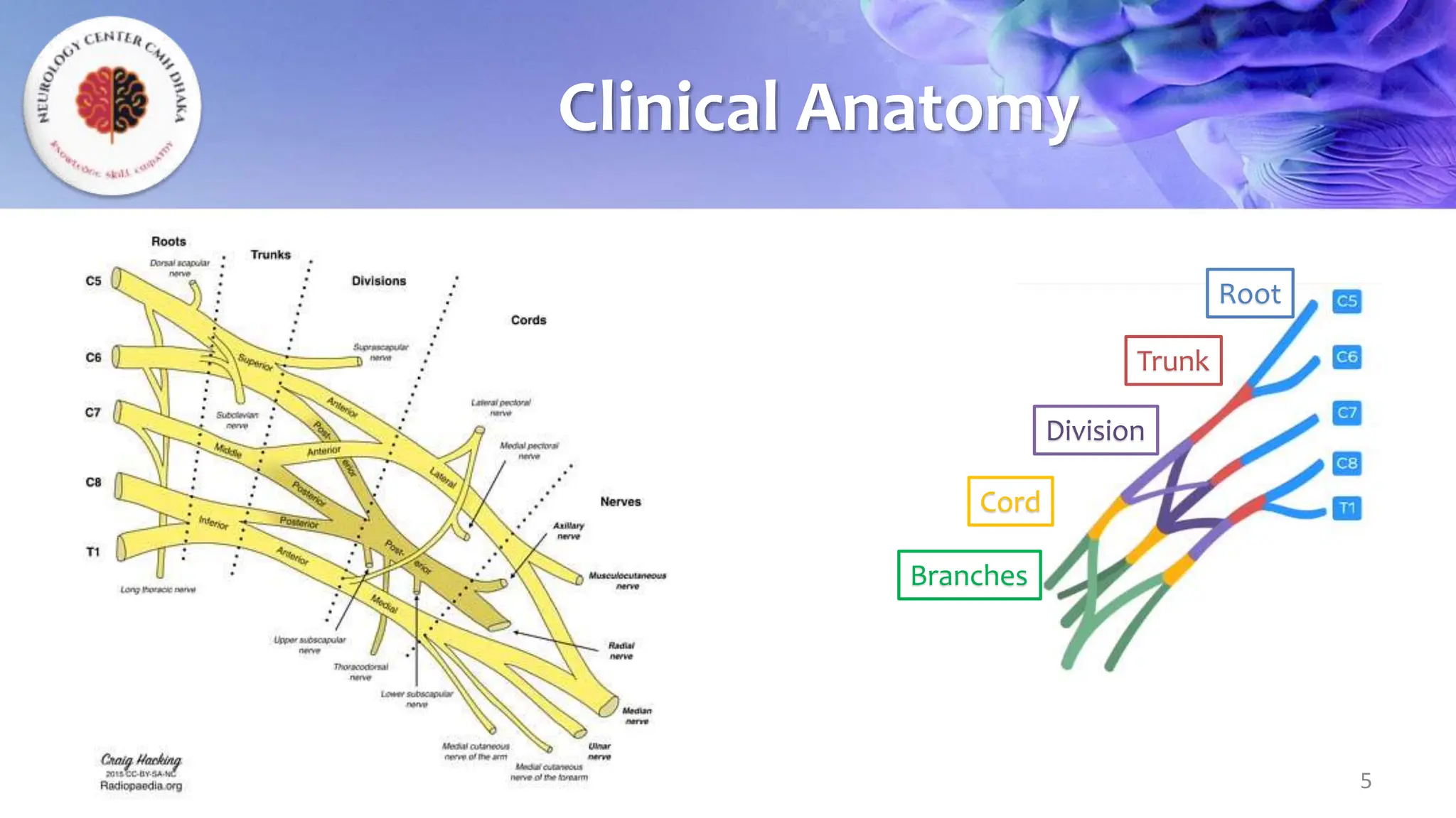 Approach to Wasted Hand (Neurology short case series).pptx