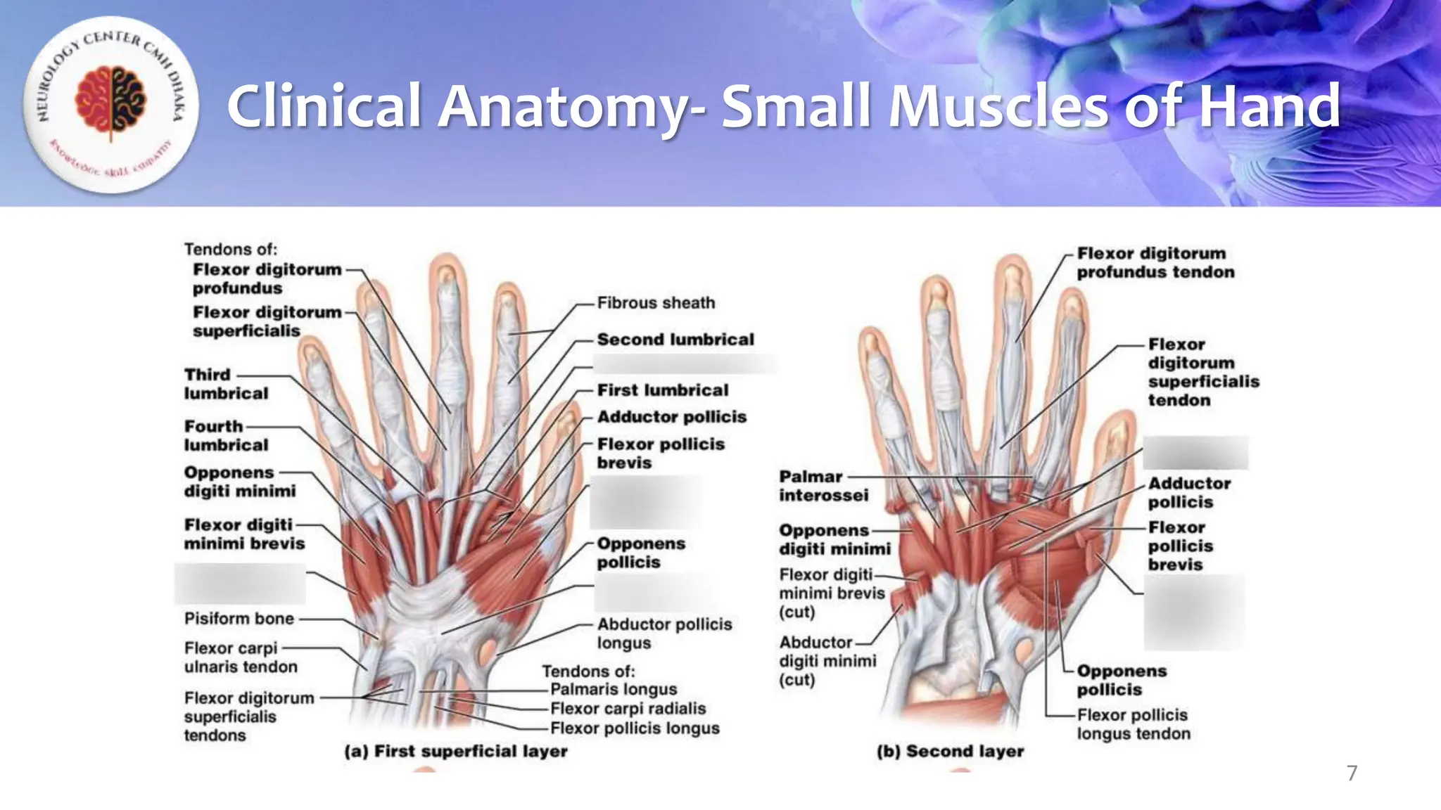 Approach to Wasted Hand (Neurology short case series).pptx