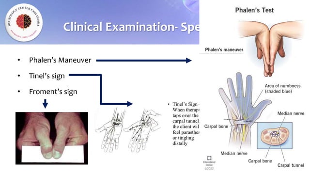 Approach to Wasted Hand (Neurology short case series).pptx