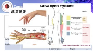 Approach to Wasted Hand (Neurology short case series).pptx