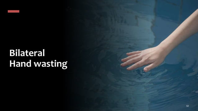 Approach to Wasted Hand (Neurology short case series).pptx