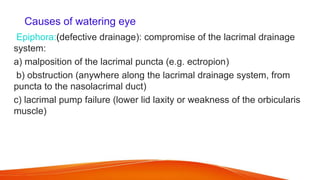 1) approach to watery eyes -lacrimal gland | PPTX
