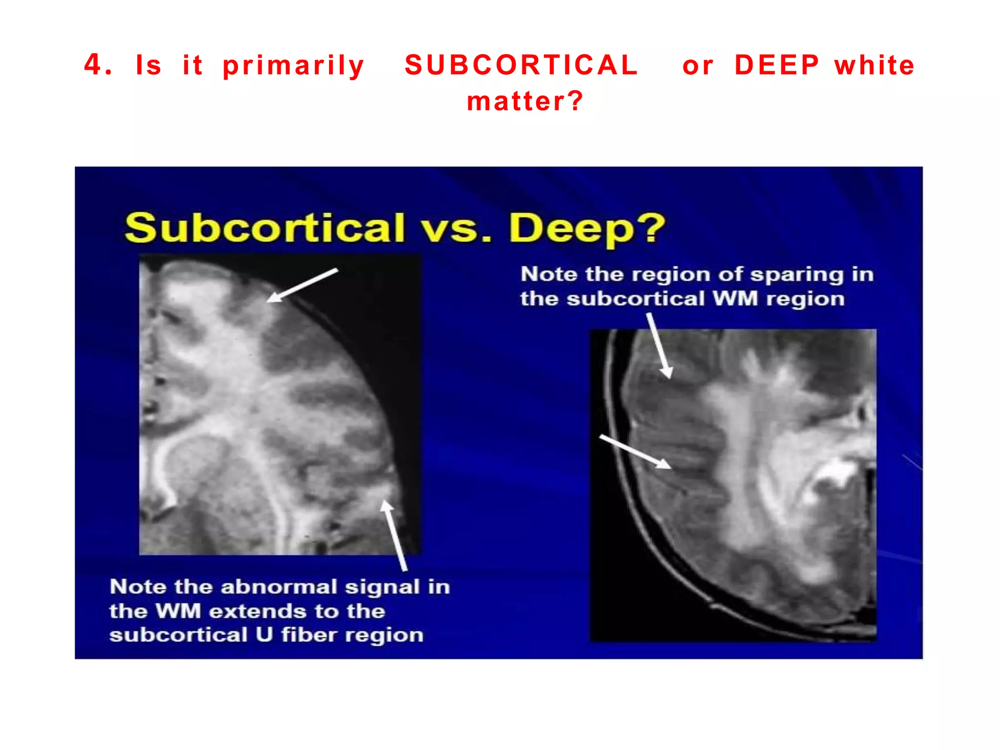 Approach to white matter disease | PPTX