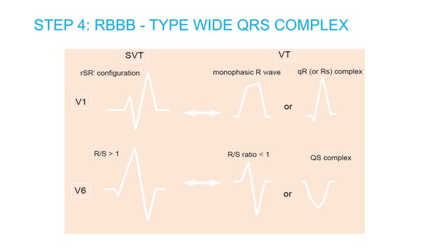 APPROACH TO WIDE QRS COMPLEXTACHYCARDIA.pptx | Heart and Cardiovascular ...