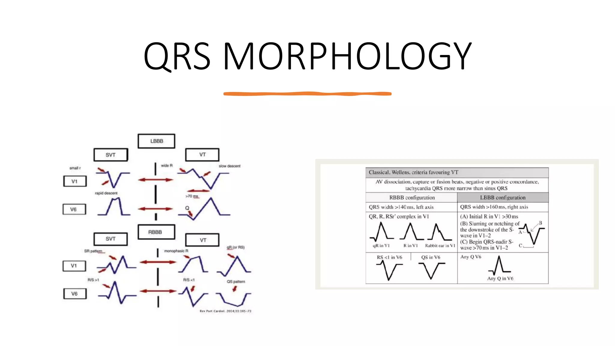 Approach to Wide QRS tachycardia.pptx