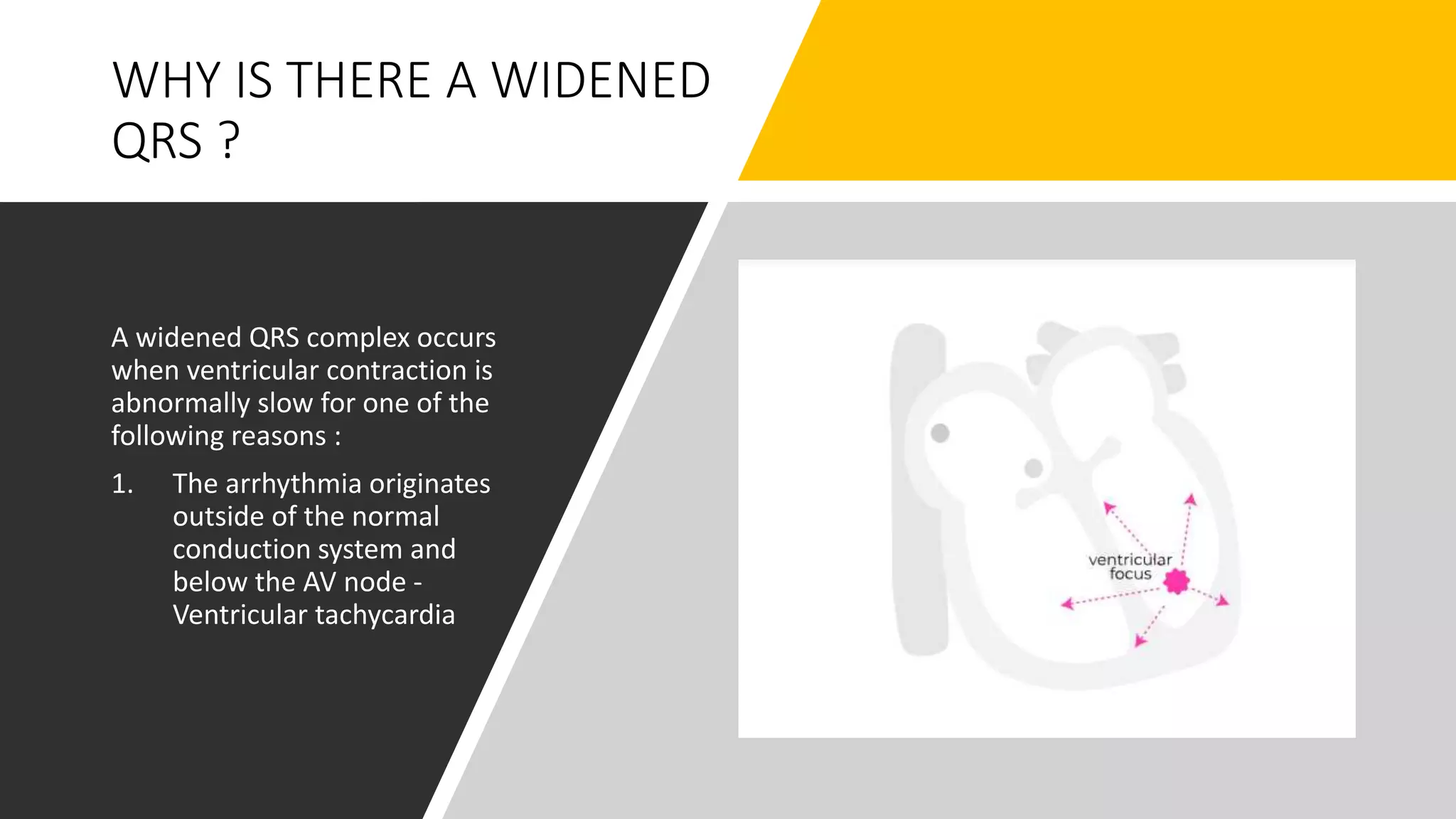 Approach to Wide QRS tachycardia.pptx