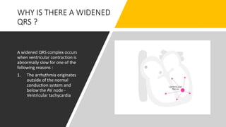 Approach to Wide QRS tachycardia.pptx