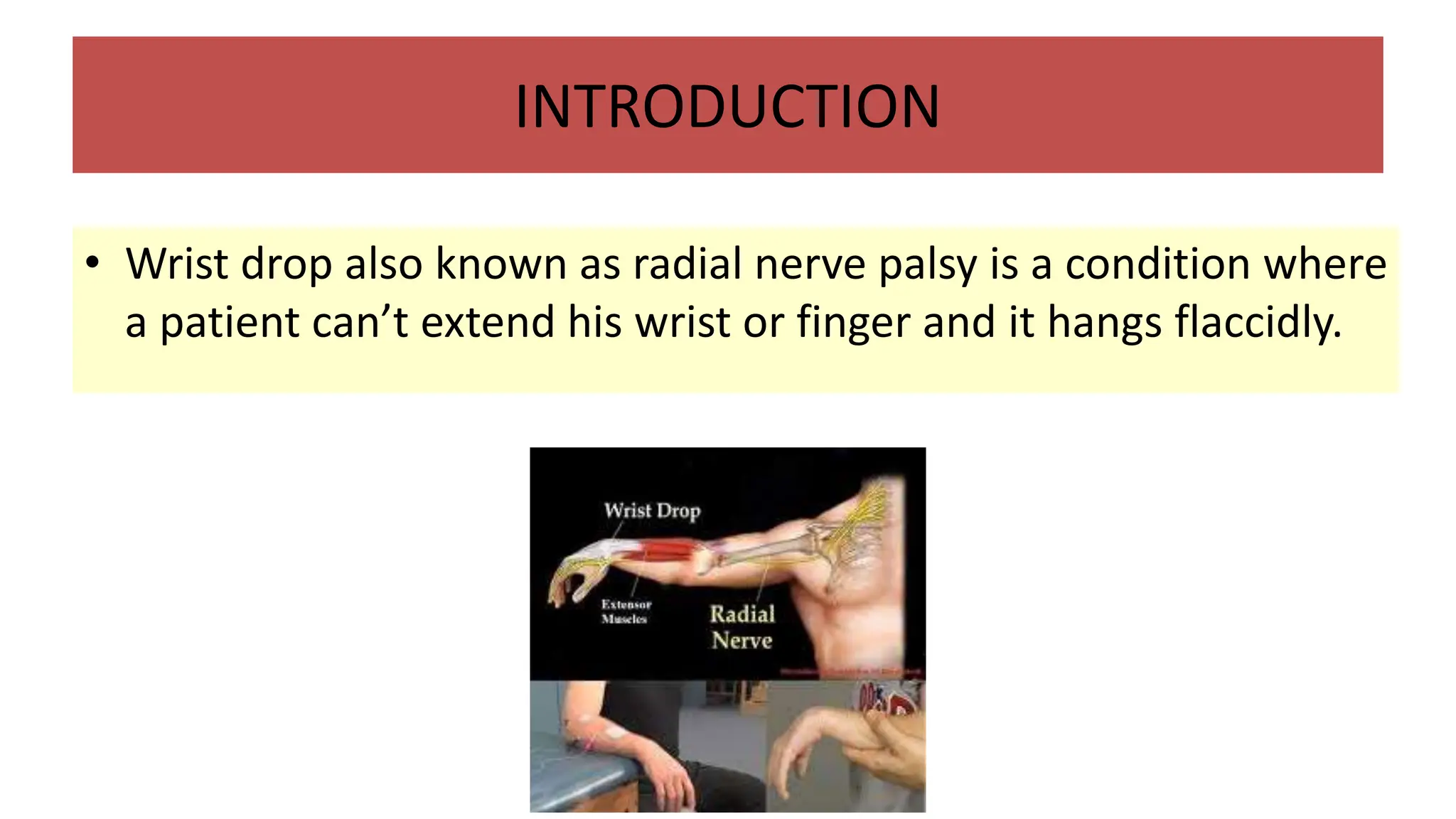 Approach to a Patient with Wrist Drop.pptx