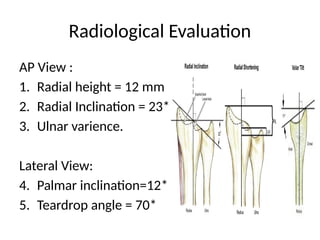 APPROCHES TO DISTAL RADIUS FRACTURES-.pptx