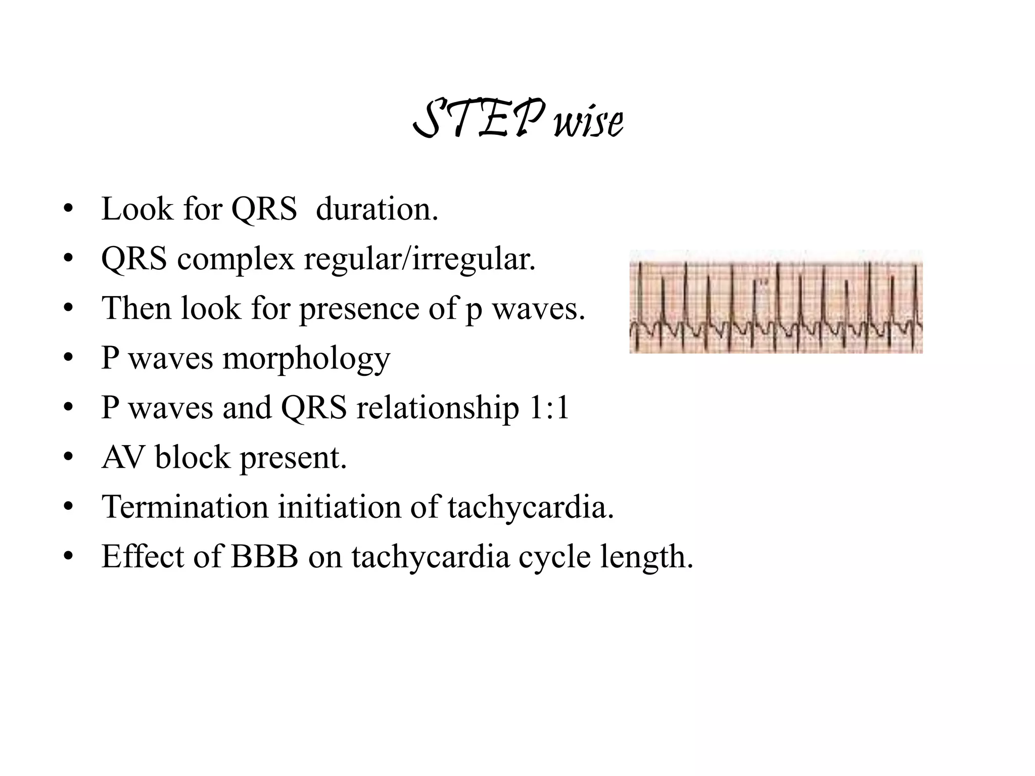 Approch narrow complex tachycardia | PPTX