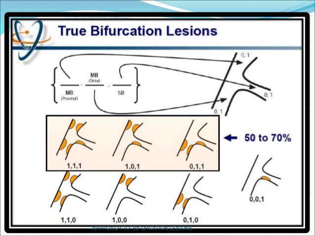 Approch to bifurcation lesion
