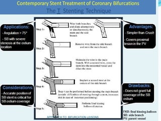 Approach to coronary bifurcation lesions | PPT