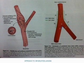 Approach to coronary bifurcation lesions | PPT