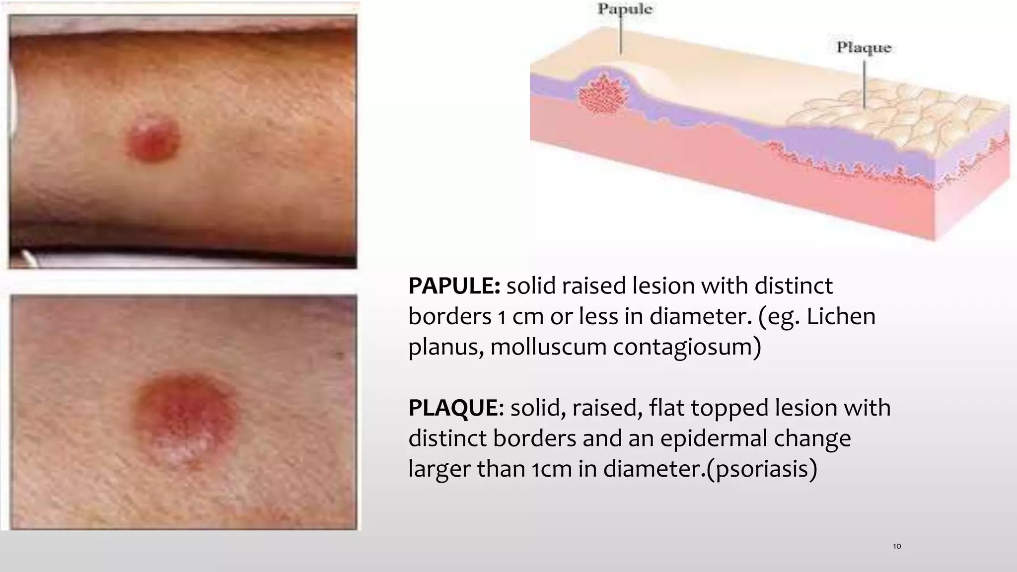 Pediatric Skin Diseases by Dr. Ramkesh Meena | PPTX