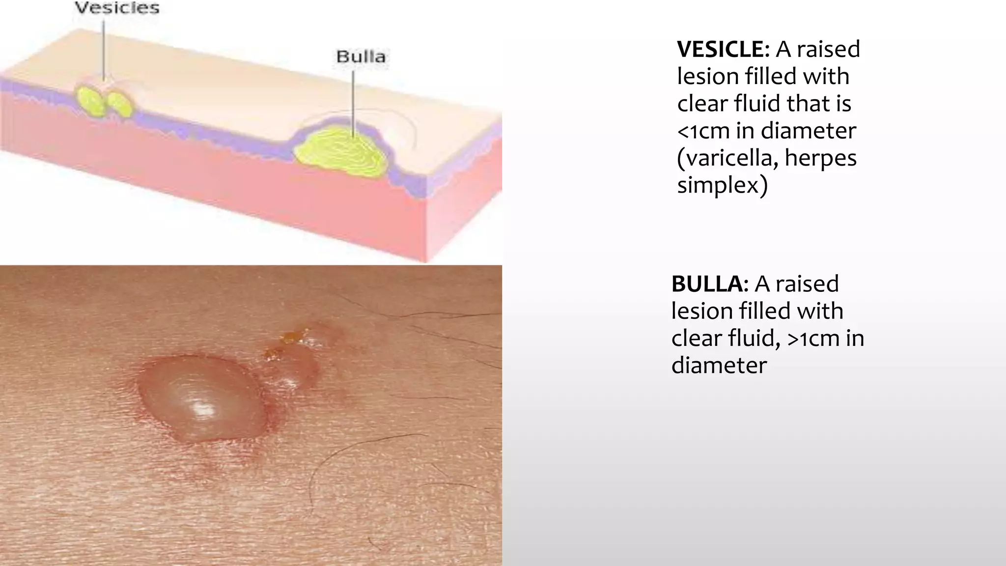 Pediatric Skin Diseases by Dr. Ramkesh Meena | PPTX