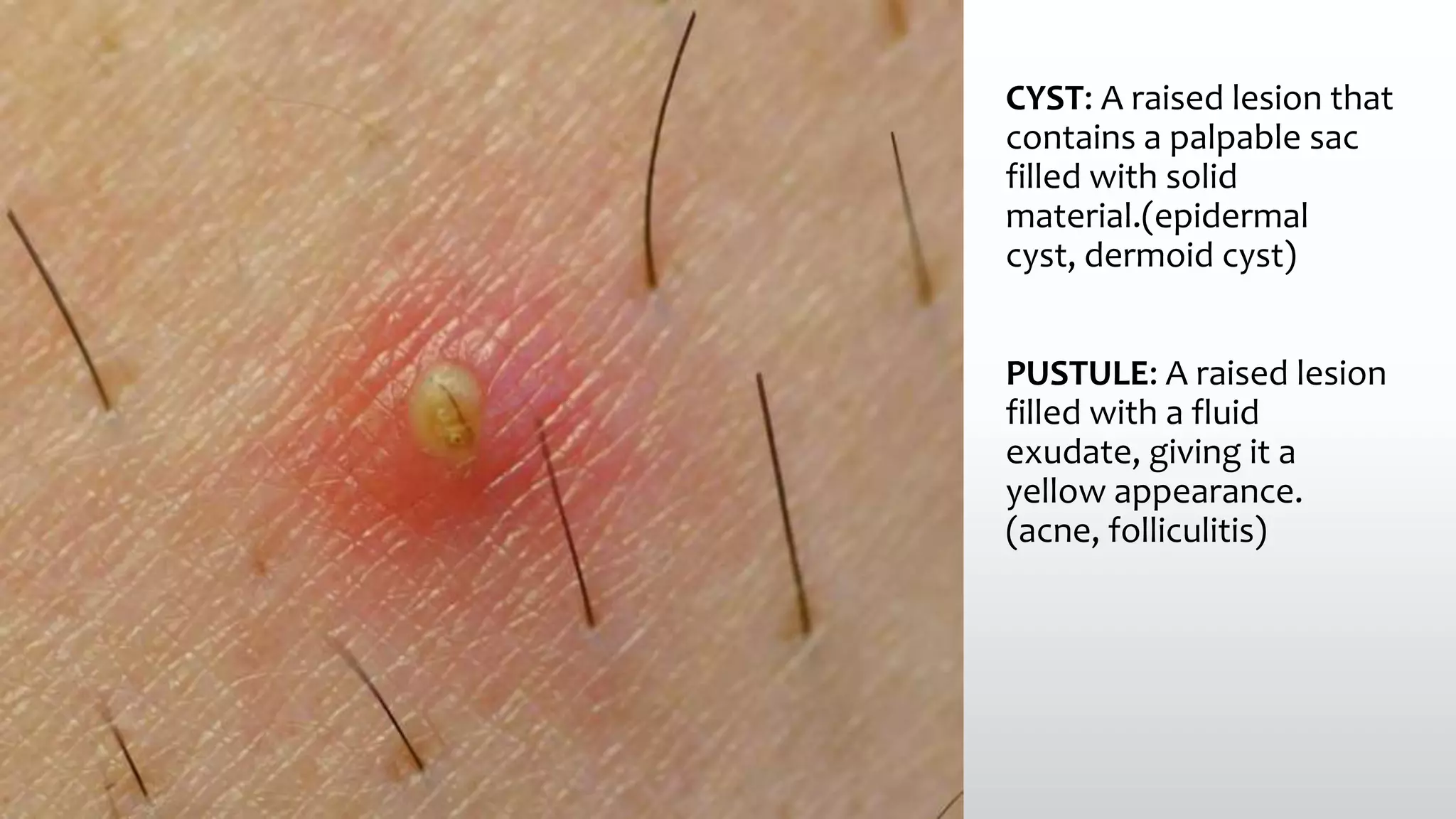 Pediatric Skin Diseases by Dr. Ramkesh Meena | PPTX