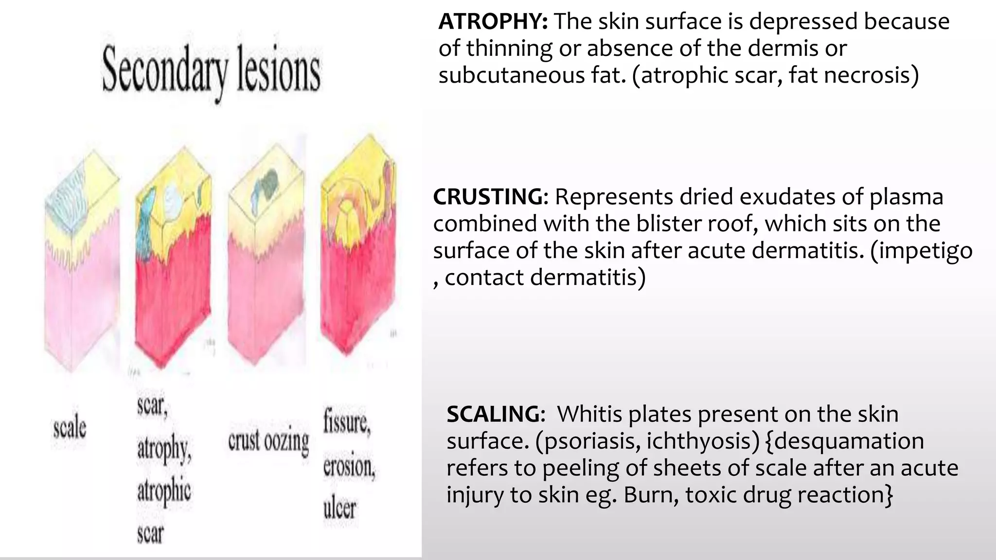 Pediatric Skin Diseases by Dr. Ramkesh Meena | PPTX
