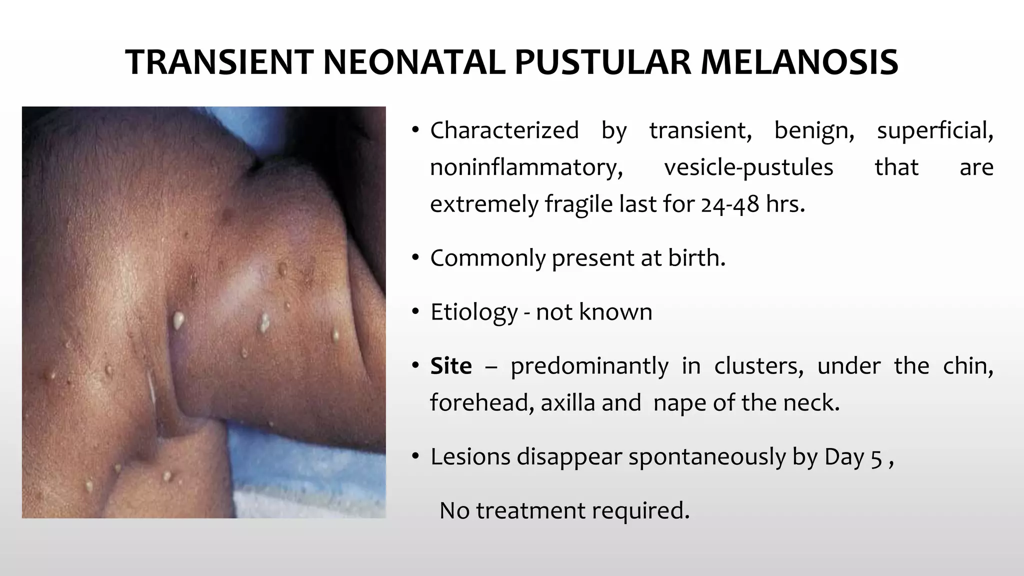 Pediatric Skin Diseases by Dr. Ramkesh Meena | PPTX