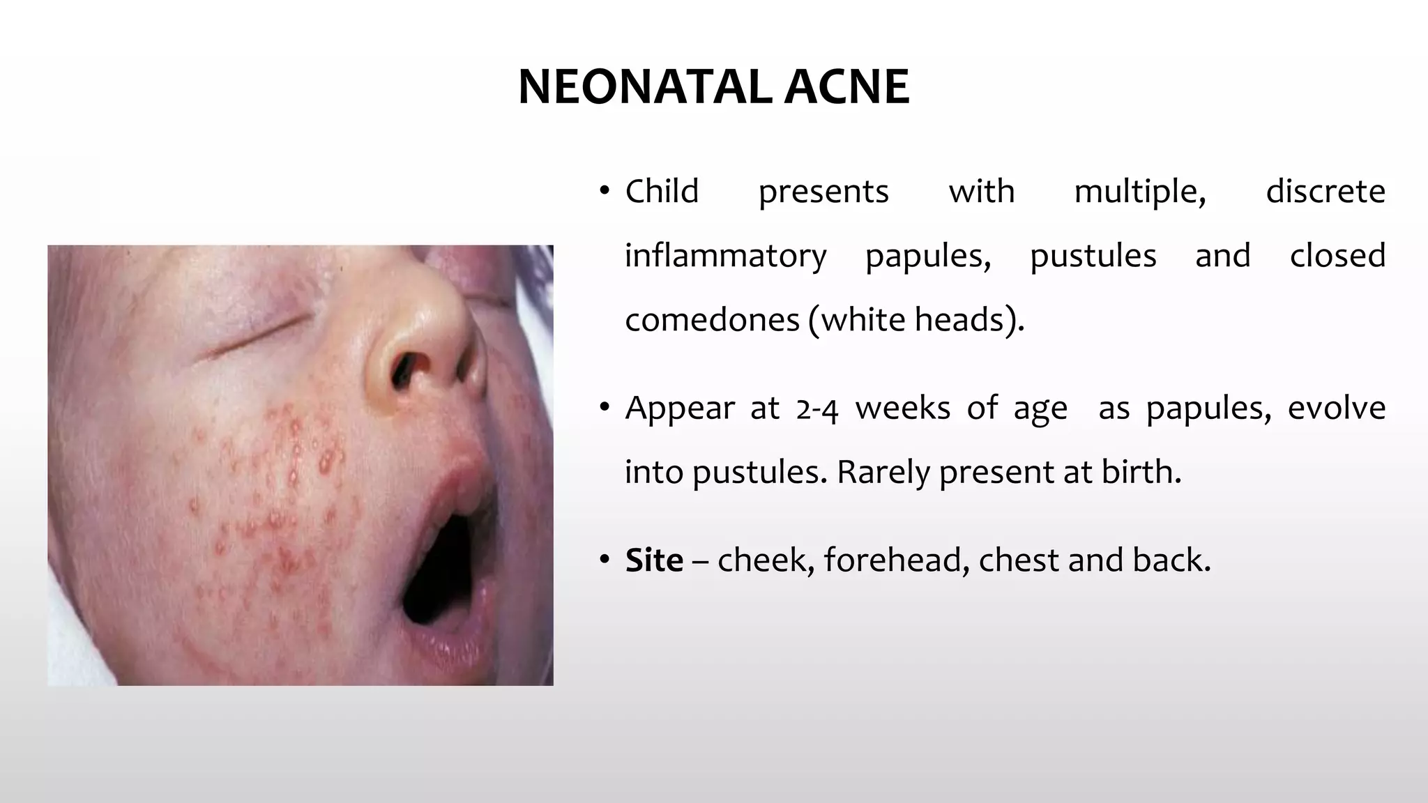 Pediatric Skin Diseases by Dr. Ramkesh Meena | PPTX